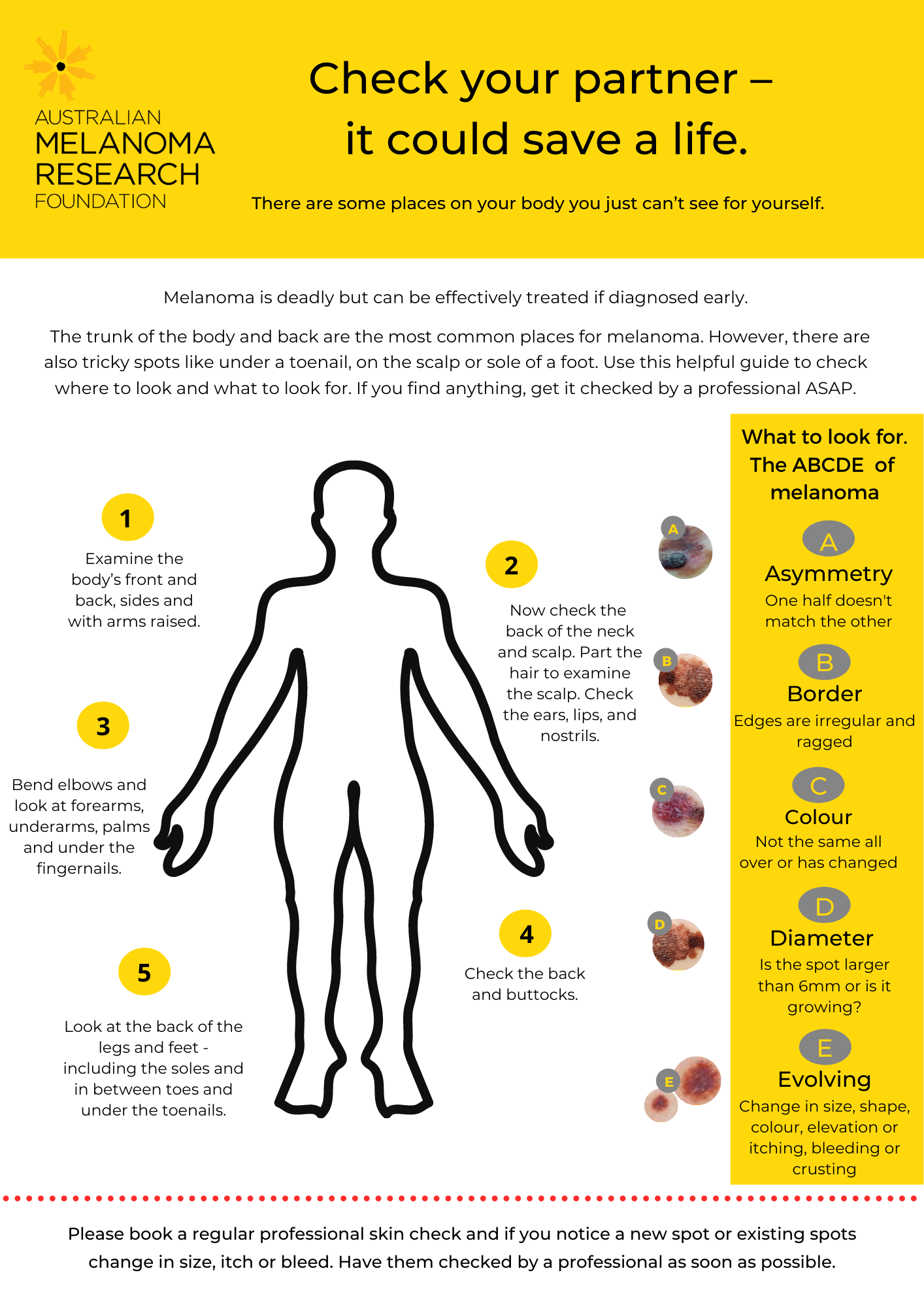 What to look for – Australian Melanoma Research Foundation